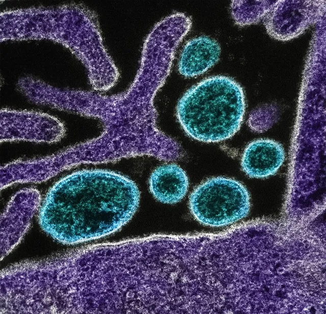 Development of an Antimicrobial Resistance Surveillance and Control ...